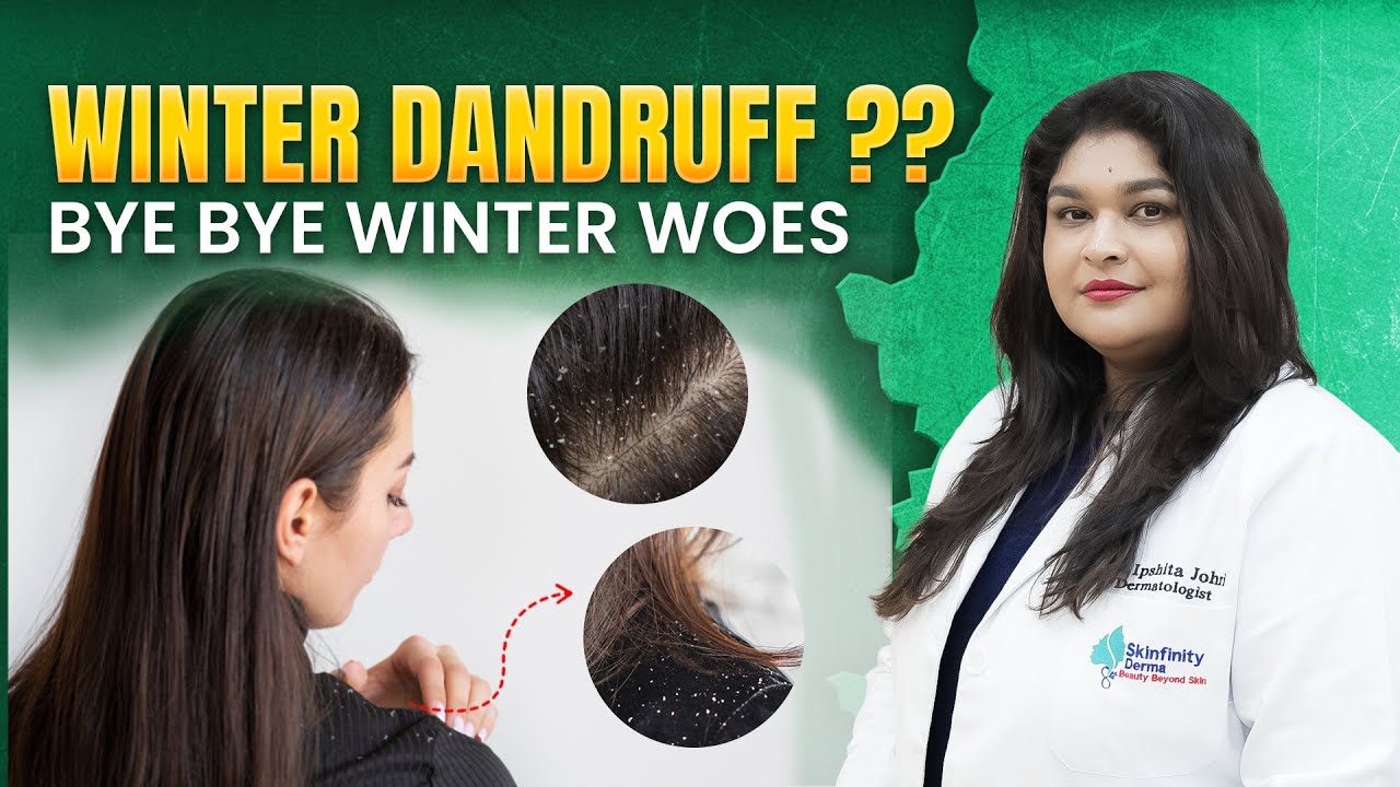 Is Winter Dandruff Secretly Causing Your Hair Loss? Discover By ...