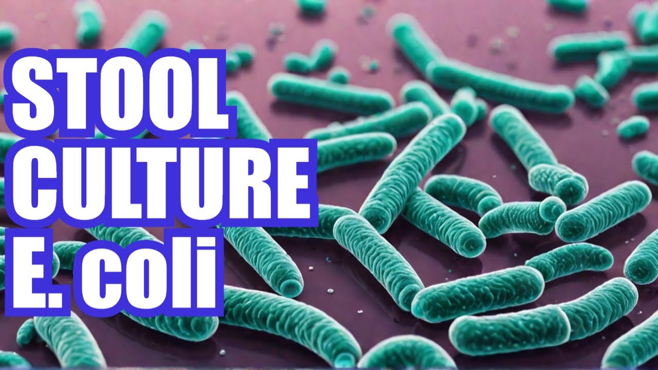 LECTURE 14: STOOL CULTURE, E. COLI 0157:H7 - YouTube