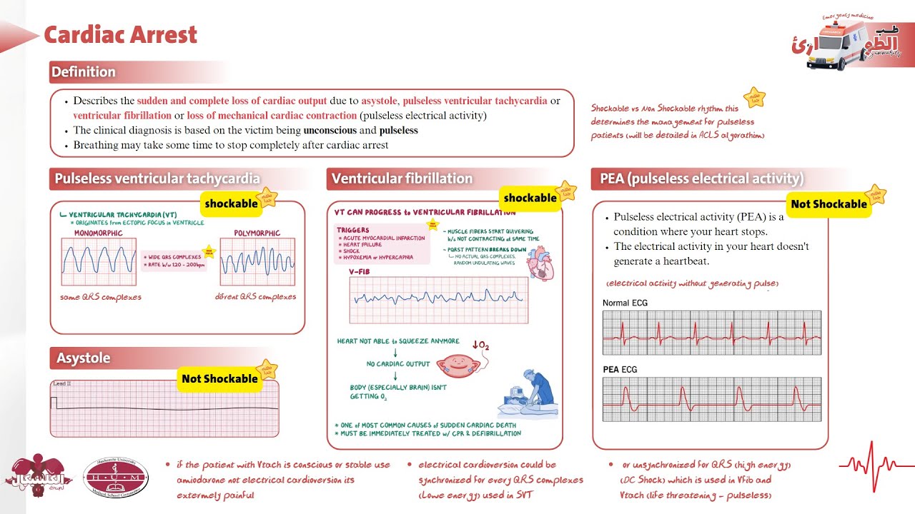 Emergency Medicine Made Easy : Cardiac Arrest - YouTube