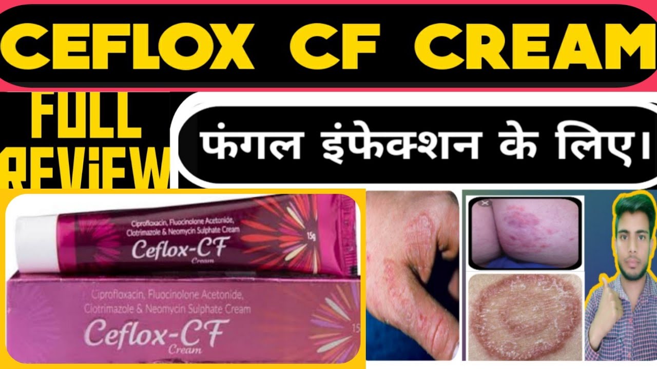 Ceflox cf cream review सुखी खारिश और दाद खाज खुजली के लिए। - YouTube