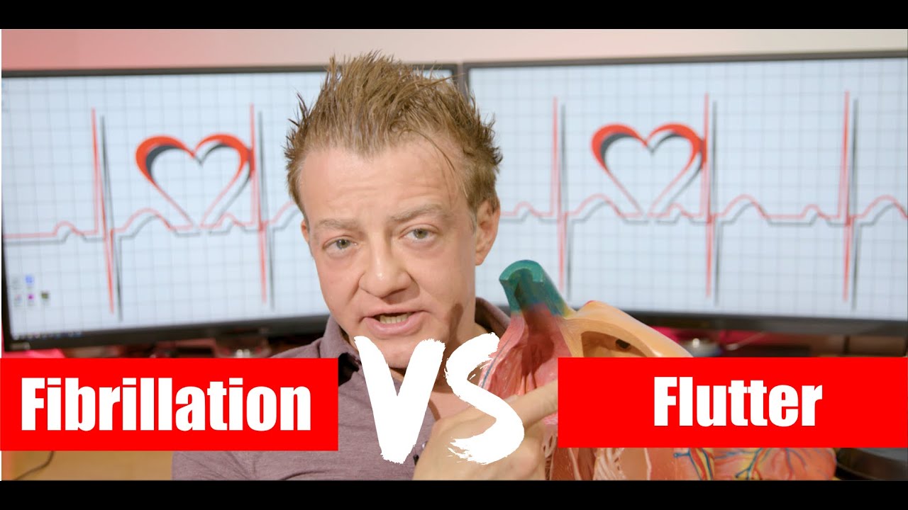 Afib vs Aflutter: What's the difference? - YouTube