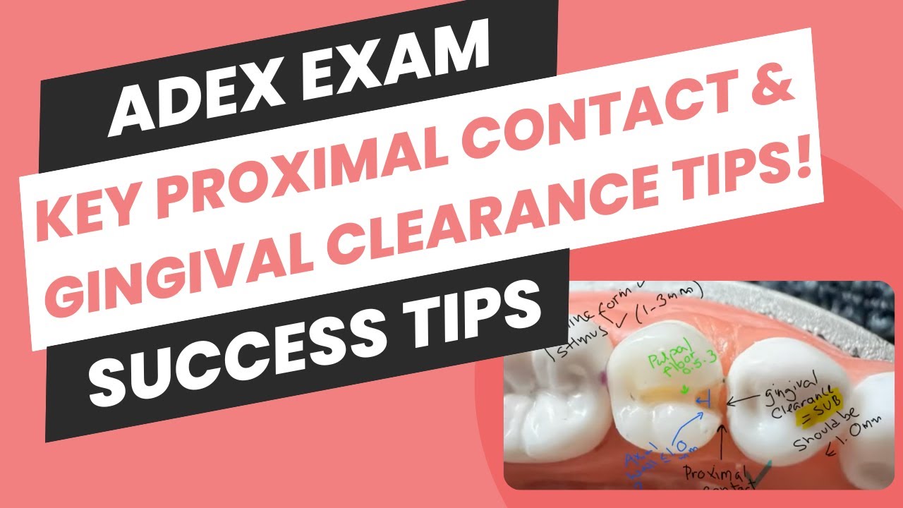 ADEX Exam Prep: Key Proximal Contact & Gingival Clearance Tips! - YouTube