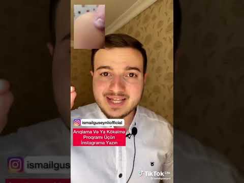 daban çatları üçün sade üsul👍🏻👍🏻⚡səyfəyə dəsdək olun😊