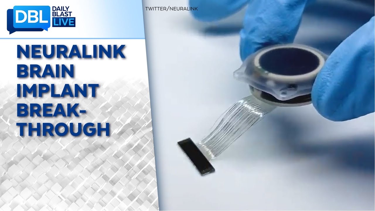 Neuralink Brain Implant Breakthrough - YouTube