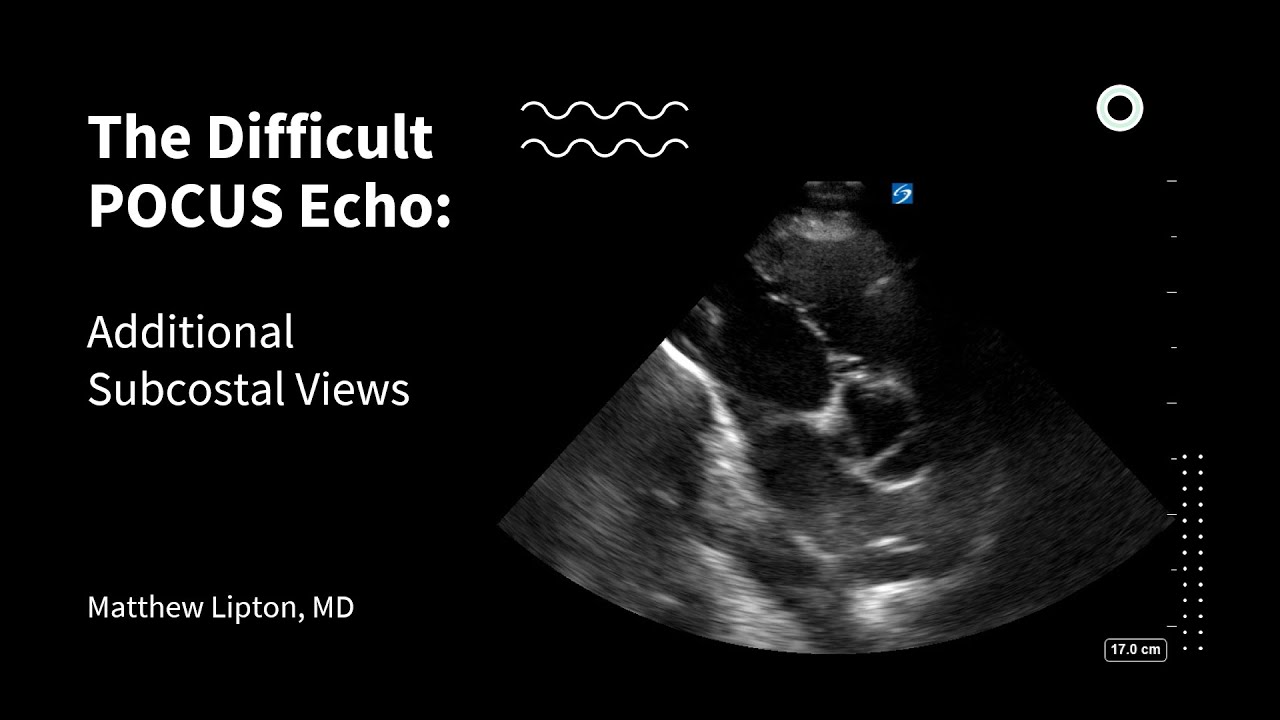 The Difficult POCUS Echo: Additional Subcostal Views - YouTube