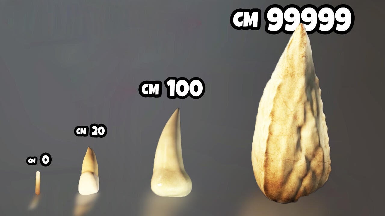 Is This THE BIGGEST TEETH? - YouTube