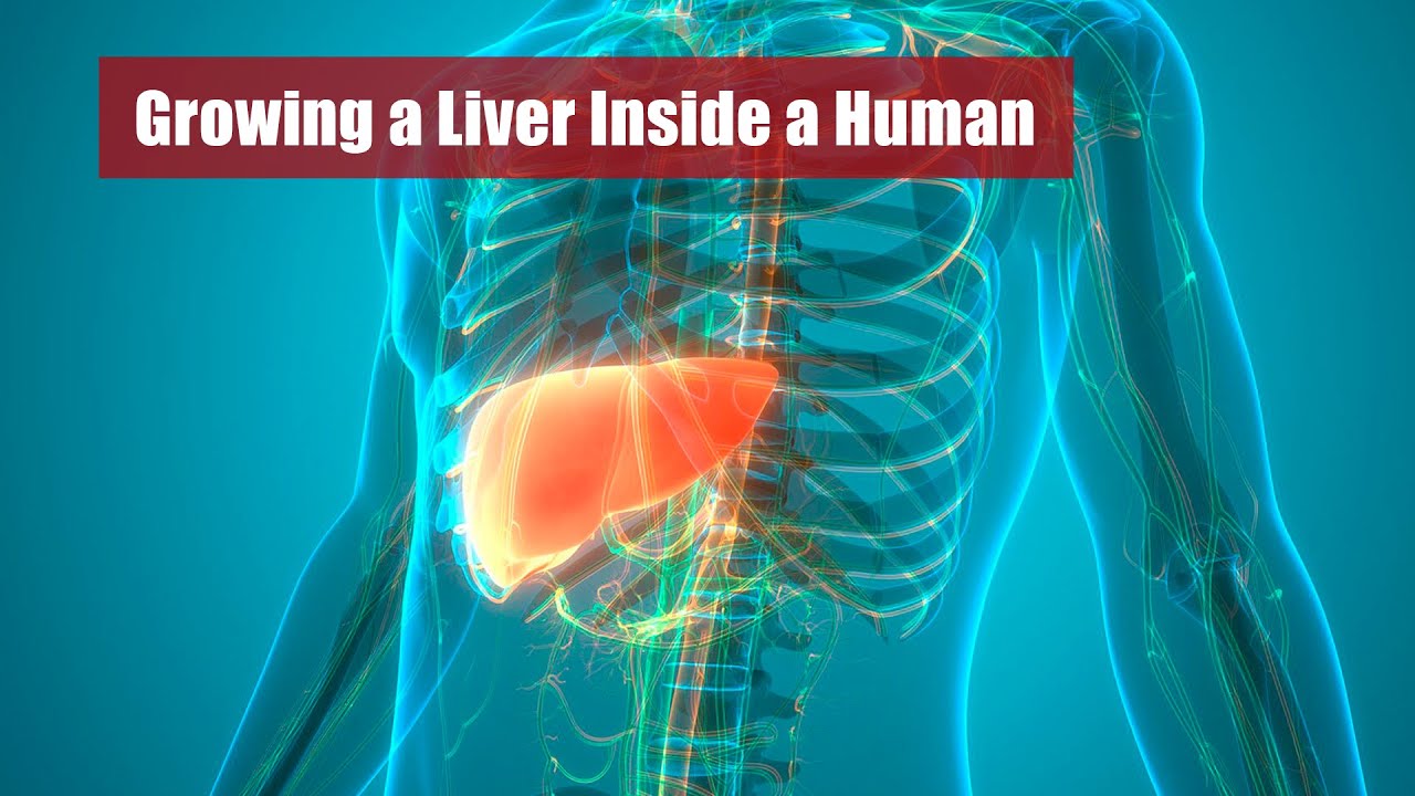 Innovative Procedure: The First Operation to Grow a Liver Inside a ...