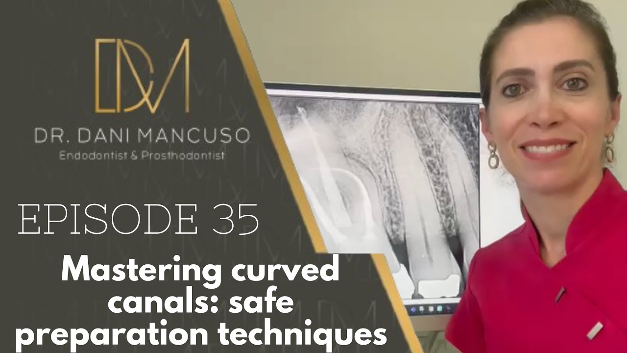 The Diary of an Endodontist - Episode 35 - Mastering curved canals ...