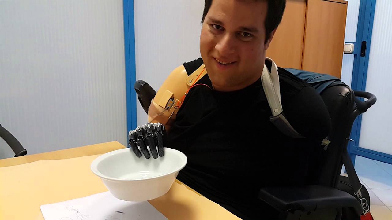 Én és a kezem - BeBionic 3# - Életem szavai - YouTube