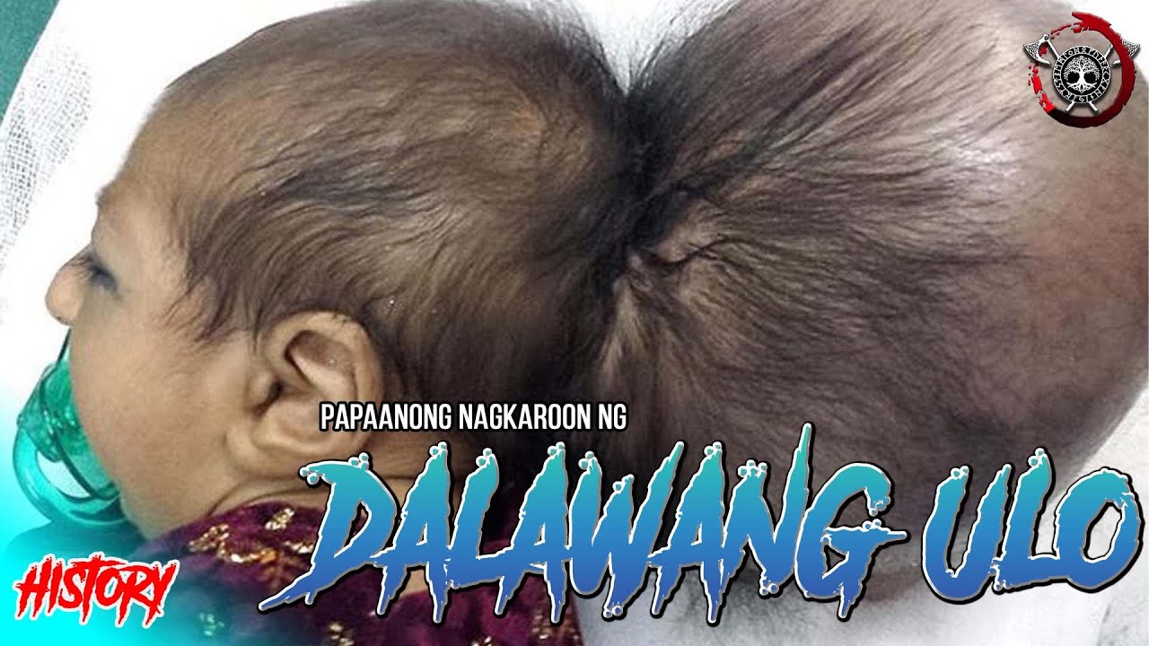 Ang batang may dalawang ulo - YouTube