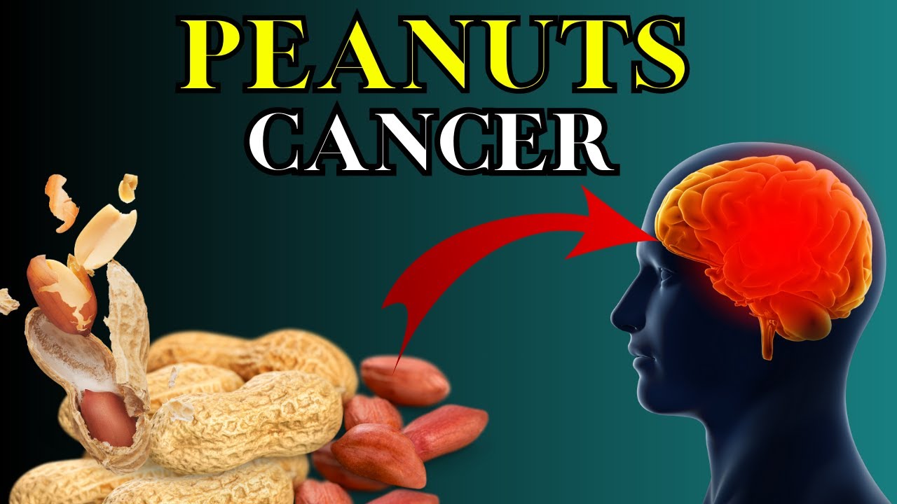 Never Eat Peanut with This 🥜 Cause Cancer and Dementia - YouTube