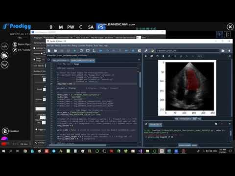 PSRT to Python AI left ventricle segmentation 20230818 - YouTube