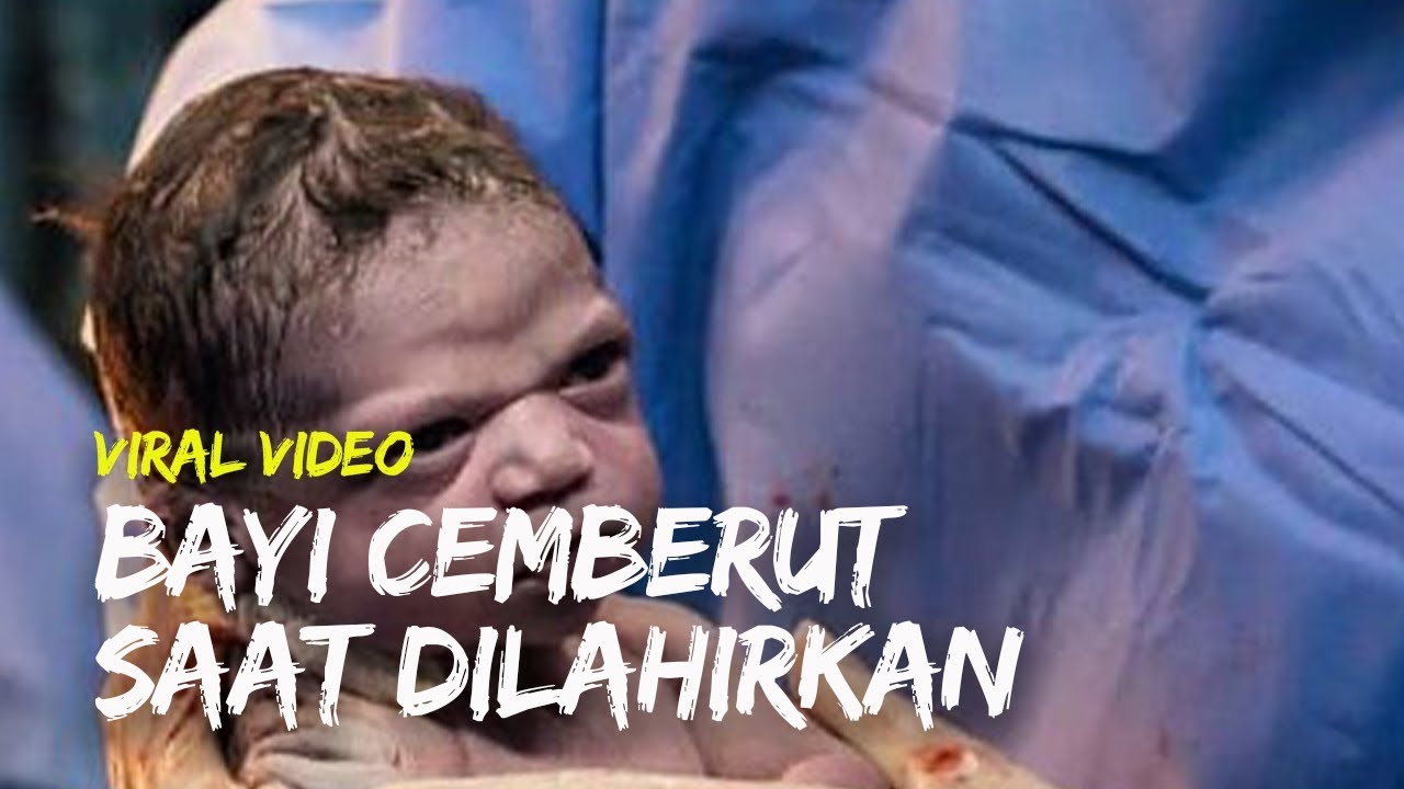 Viral Video Lahirnya Seorang Bayi dengan Ekspresi Cemberut saat ...