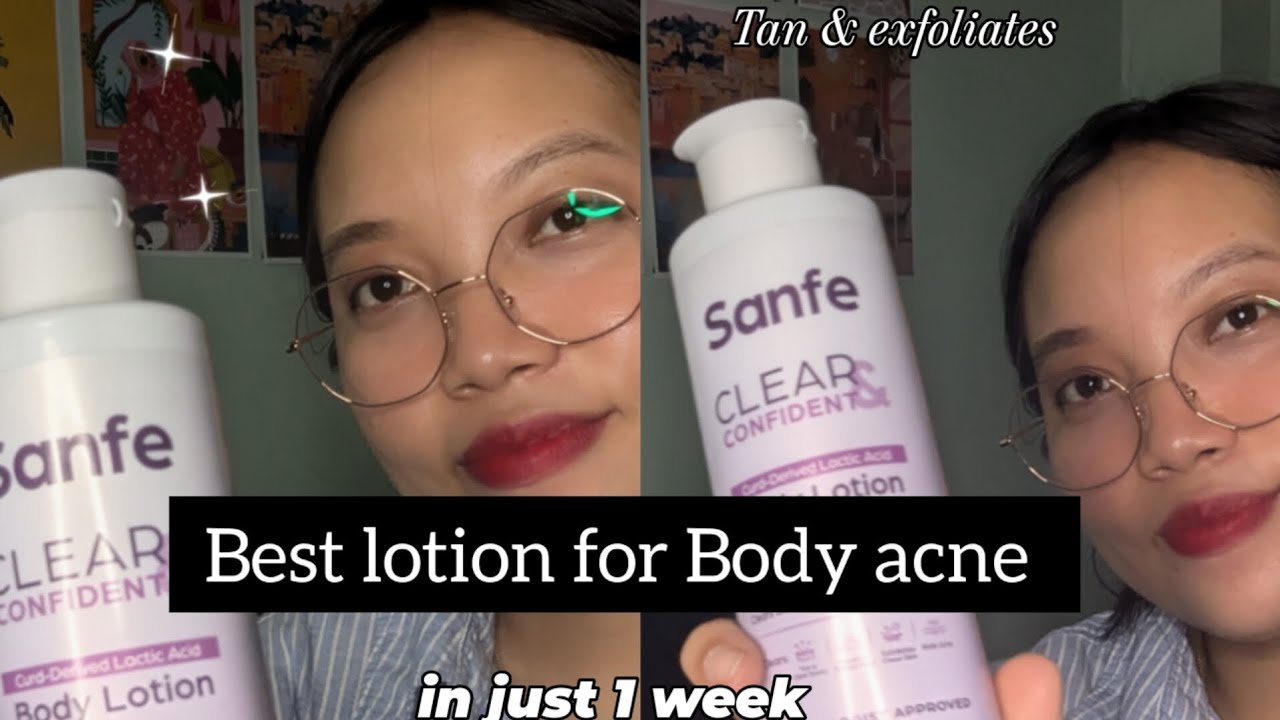 Review of Sanfe Glycoclear Body lotion | #clearskin #bodylotion # ...