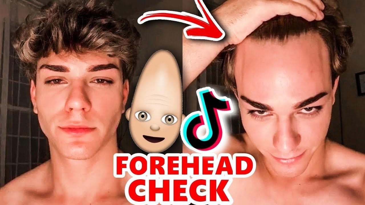 Worlds Worst BAD Hairline Check (TikTok Compilation) - YouTube