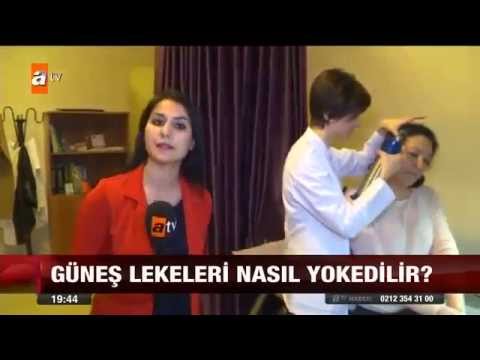 Güneş Lekelerine Kriyoterapi Çözümü