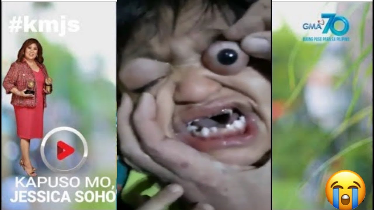 Kapuso mo, Jesicca Soho: BATANG NAG VIRAL LUMUWA ANG MATA UMANI NG ...