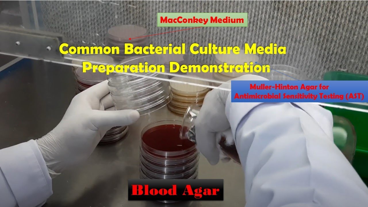 Macconkey, Blood and Muller-Hinton agar Preparation - YouTube