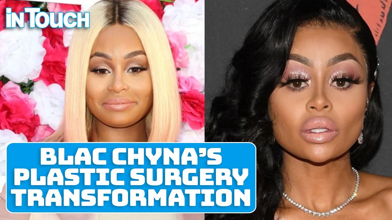 Blac Chyna’s Plastic Surgery Transformation - YouTube