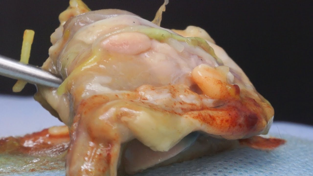 Extremely Long Toenails, Abnormal Growth Of Black Mud 👣 Professional pedicure process #090201 ...