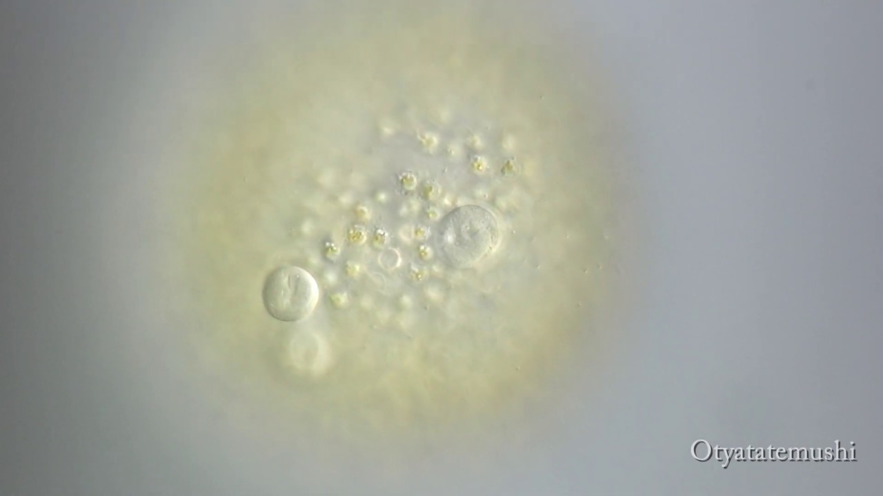 ウログレナの一種（Uroglena sp.） - YouTube