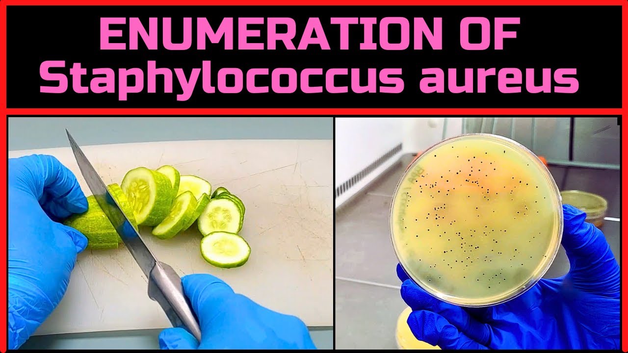 Enumeration of Staphylococcus aureus in Food | A Complete Procedure ...