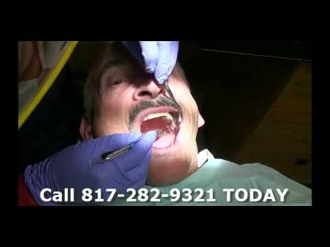Part 14 Kyle Eberlein DDS Excess Glue Removed From Temporary Bridge - YouTube
