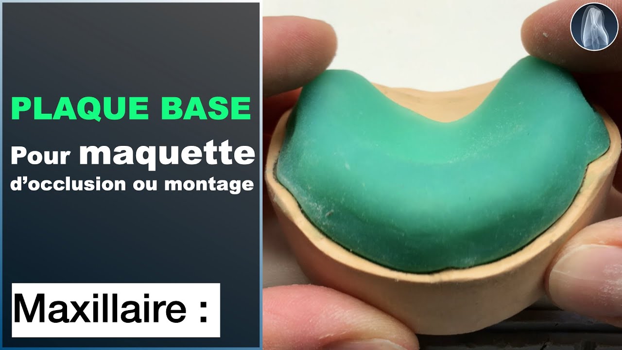 Maîtrisez la résine photopolymérisable : Préparer une base parfaite ...