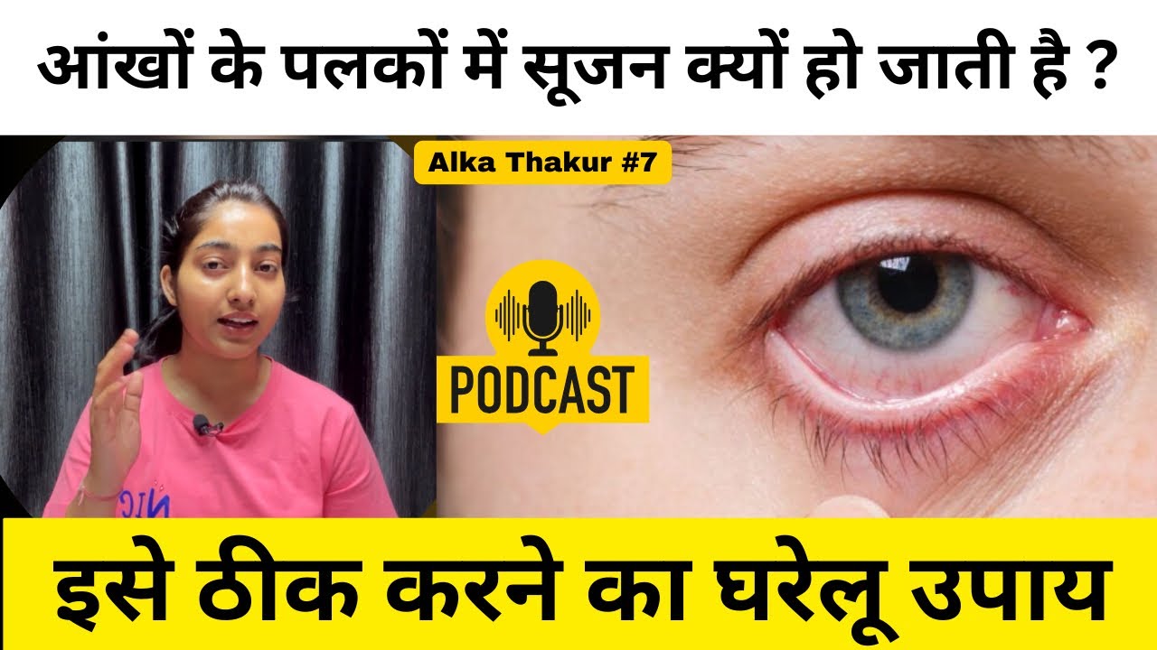 आँखों के पलकों में सूजन क्यों हो जाती है ?|इसे ठीक करने का घरेलू उपाय ...