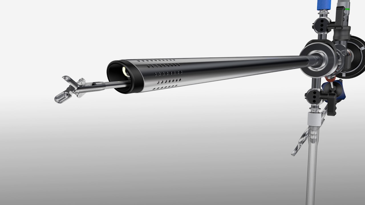 Resectoscopio Ginecológico RICHARD WOLF PRINCESS - YouTube