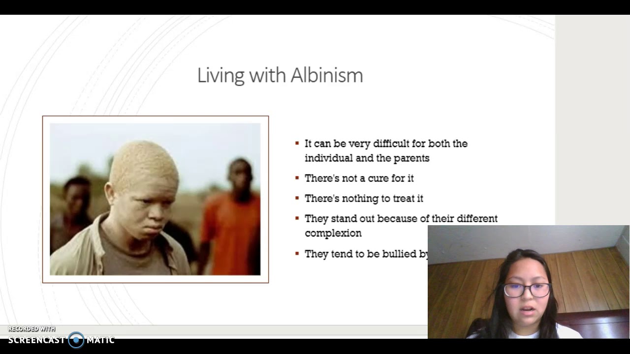BIO 165 Albinism PPT - YouTube
