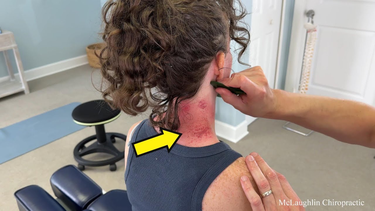 It's Unbelievable...PURPLE Marks Pour Out Of Her Neck! Tech Neck & Jaw ...