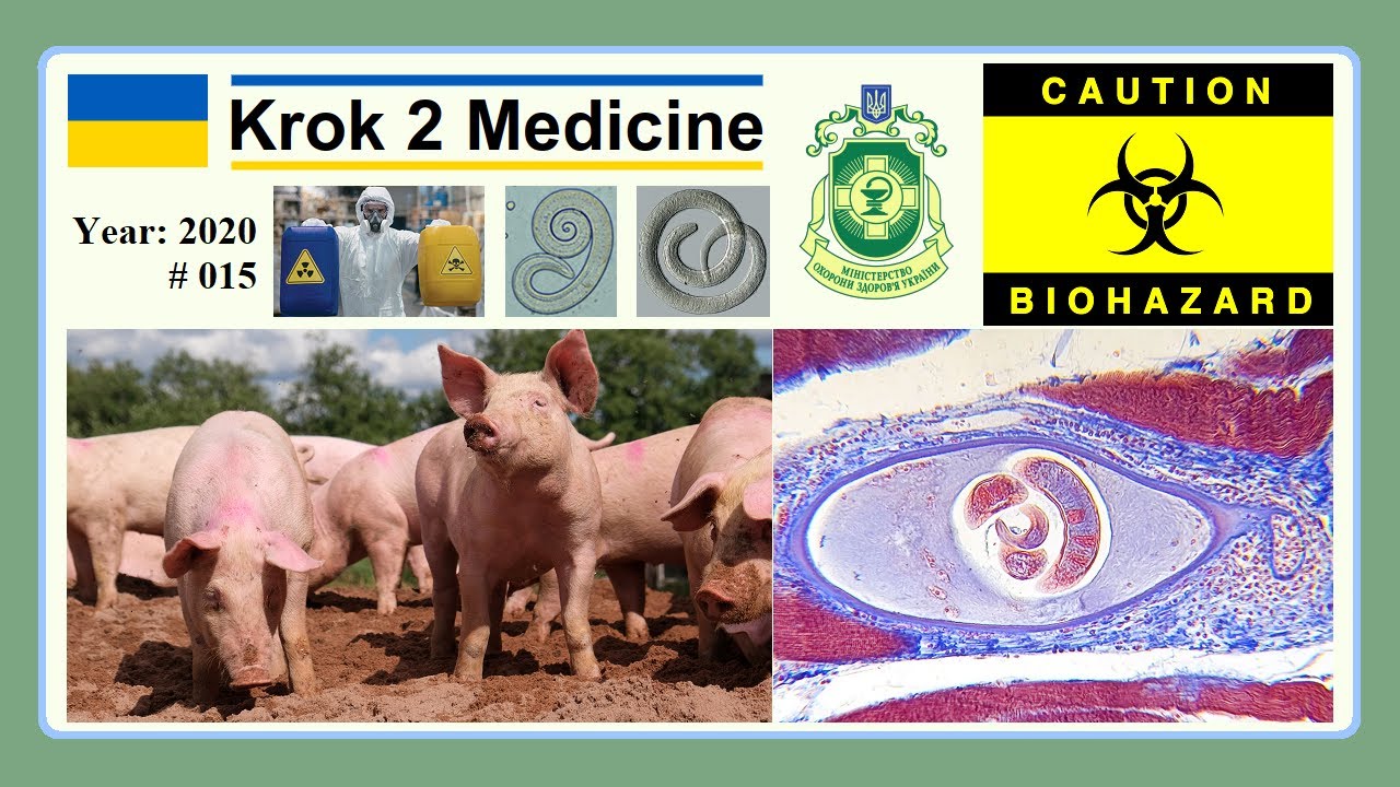[ Krok 2 Medicine ] Year: 2020 - 015 (Ministry of Public Health of ...