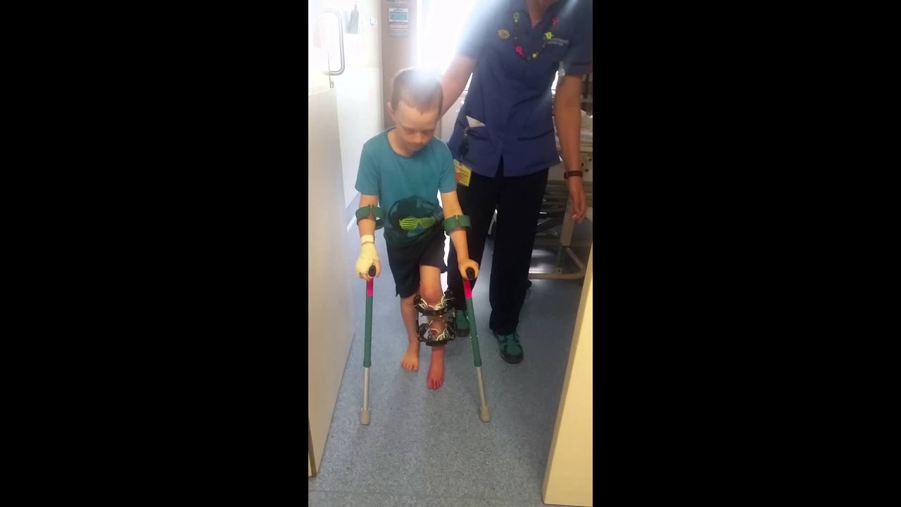 Taylor spatial frame. . - YouTube