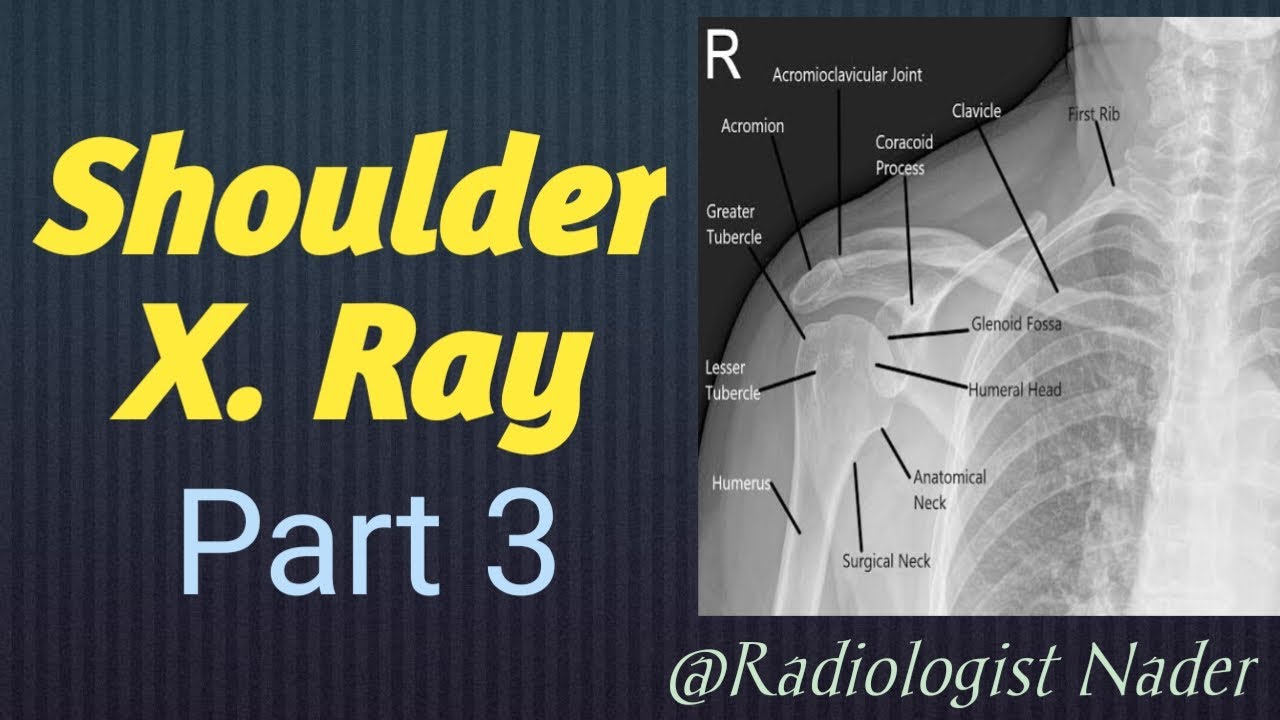 اشعة عادية علي الكتف . الجزء الثالث اوضاع تصوير الترقوة.Shoulder X.Ray ...