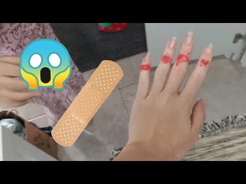 Eylülün Annesinin Eli Dolaba Sıkıştı Eylül Yara Bandı Yapıştırdı | fun kids video