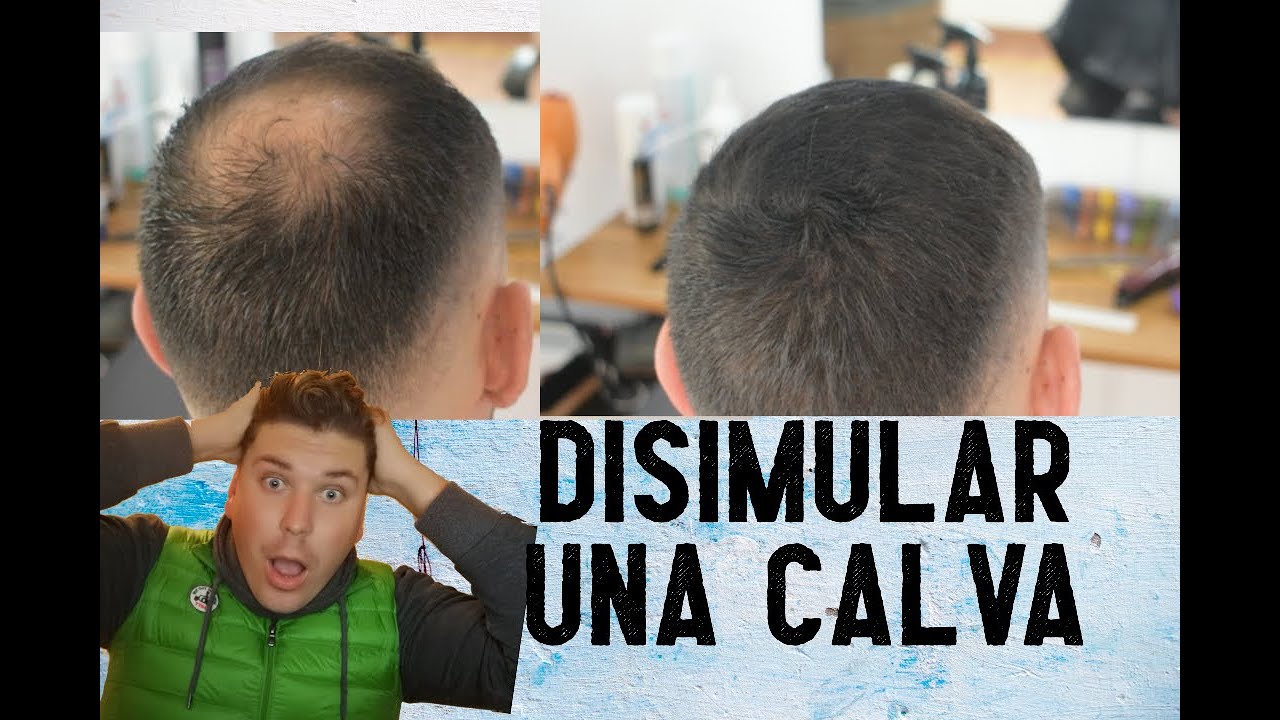 DISIMULAR UNA CALVA - YouTube