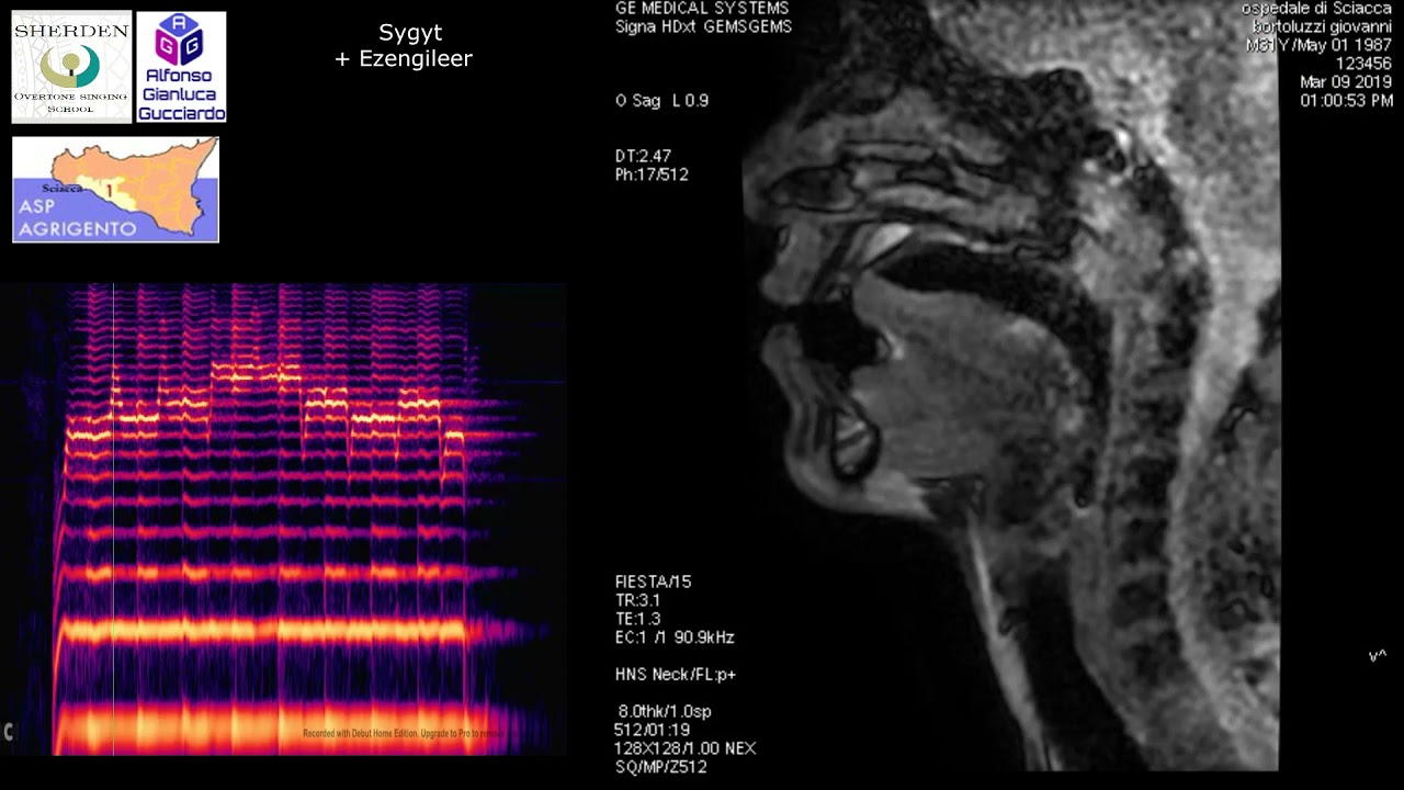 FIESTA IMAGING VIDEO EXTRACTS: Canto Difonico/Overtone singing in MRI ...