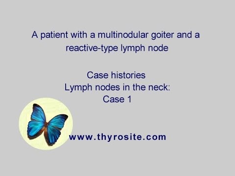Benign, reactive-type lymph node. Lymph nodes in the neck - case 1 ...