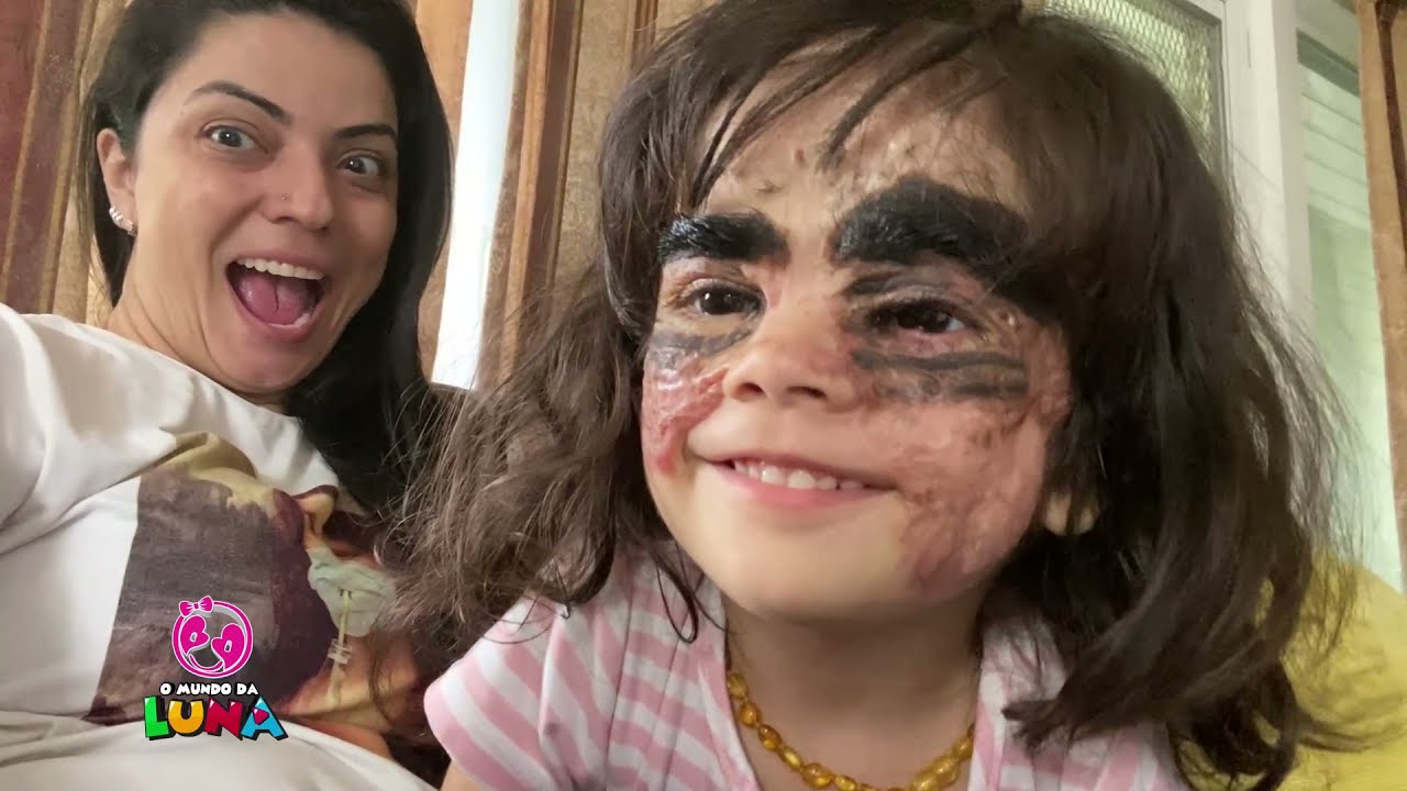 The baby with a mask on her face was cured: there are no more spots ...