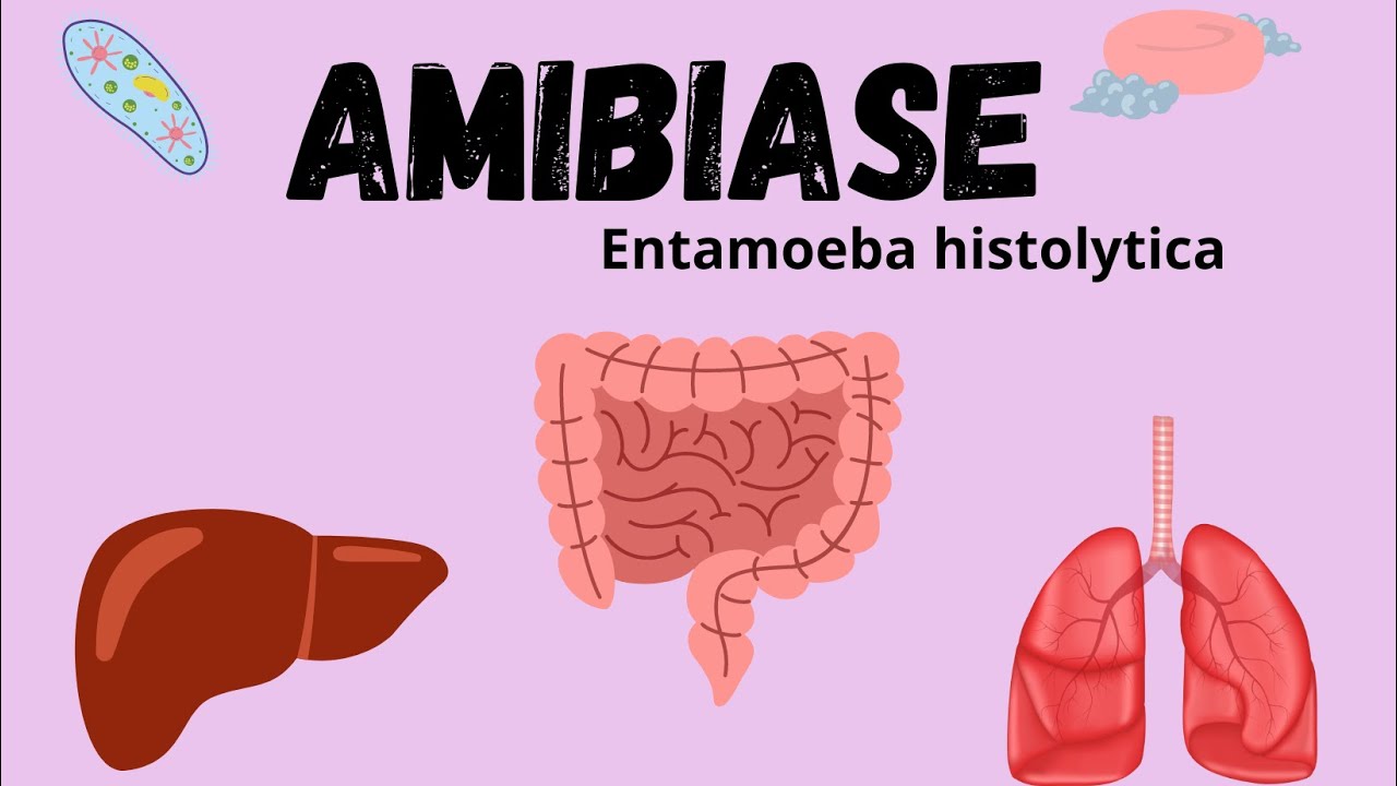 amibiase 1ére partie by Nélma - YouTube