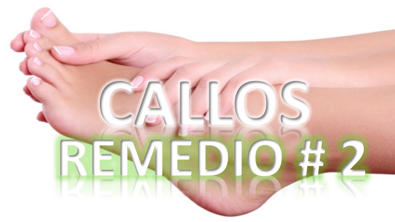 Callos | 02 | Remedios Caseros Para Los Callos | Callos De Los Pies ...