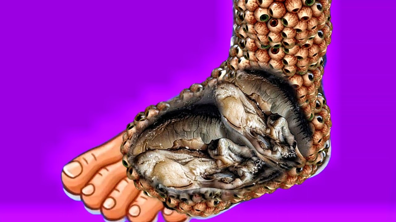 ASMR Animation Trypophobia Big size treatments knee | ASMR animation ...