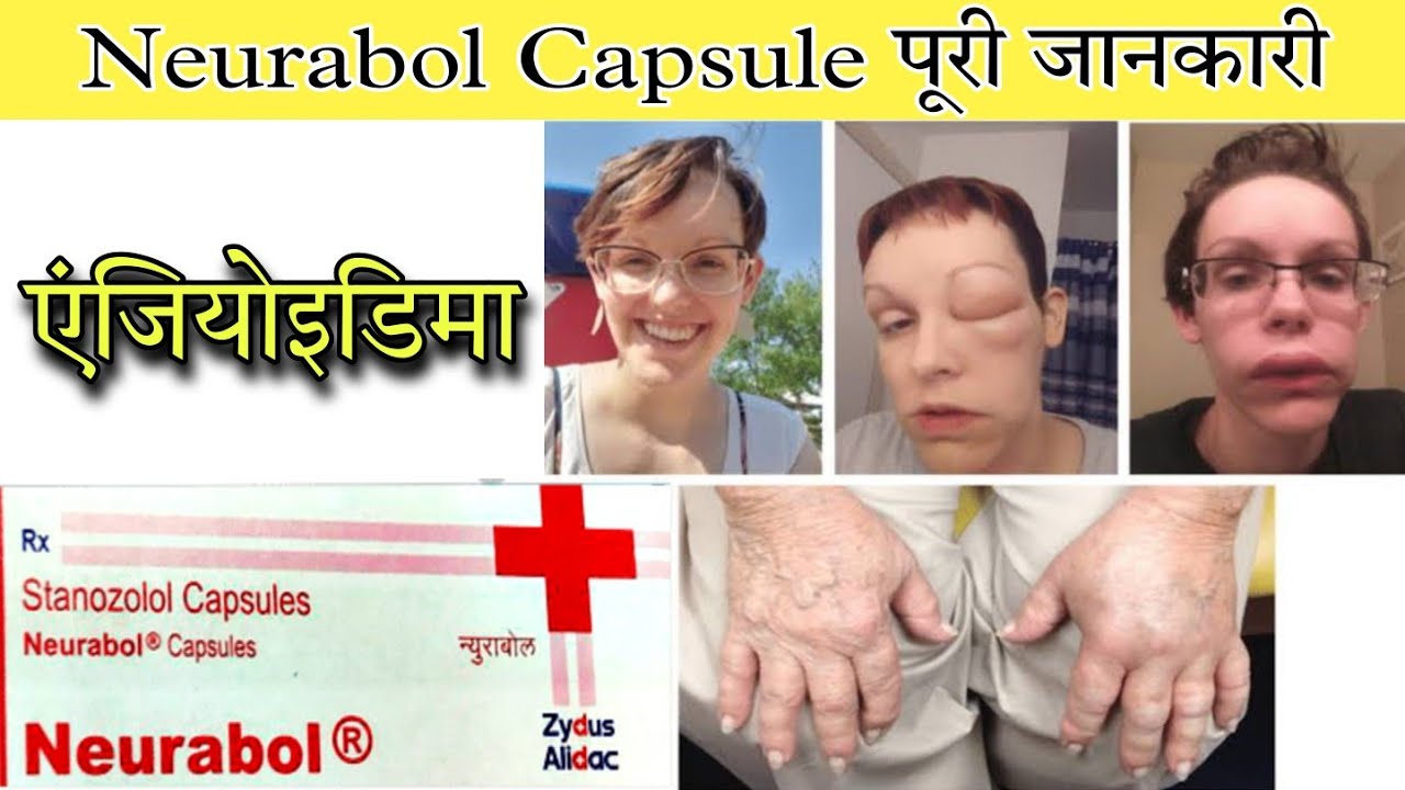 Neurabol Capsule | Stanozolol Capsule | Uses | Dose | Side-effects ...