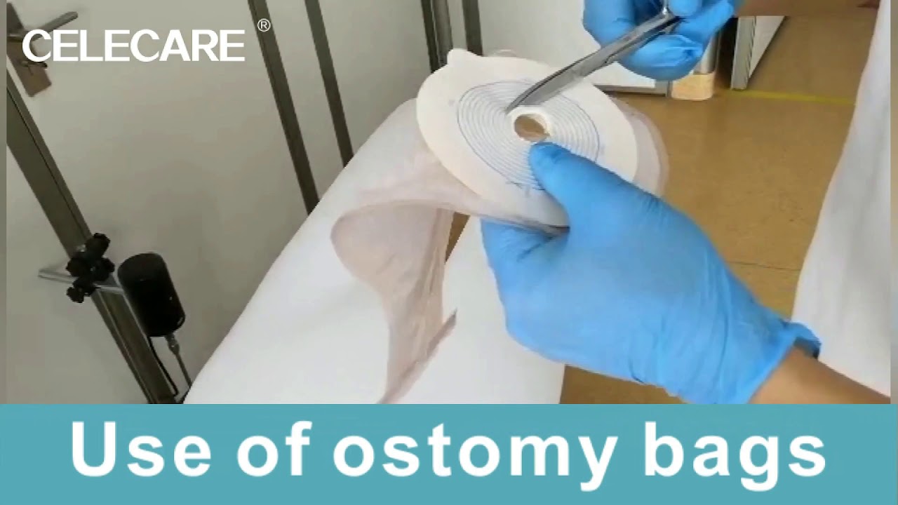 One-piece ostomy pouch, open ostomy bag from Celecare - A001 - YouTube