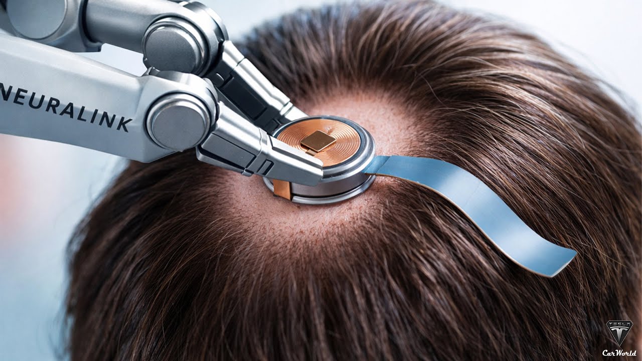 Elon Musk’s Neuralink 2026: 1,000 Trial Brain Chip for Patients Using ...