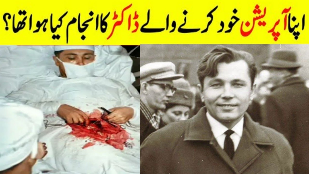 Why Doctor Leonid Rogozov Make His Own Surgery? || Merical Of Medical ...