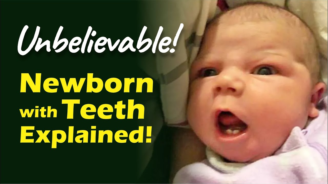 Baby Born with Teeth? Here’s What You Need to Know! - YouTube
