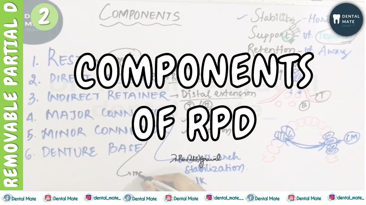 Components of Removable Partial Denture | Retention | Stability ...