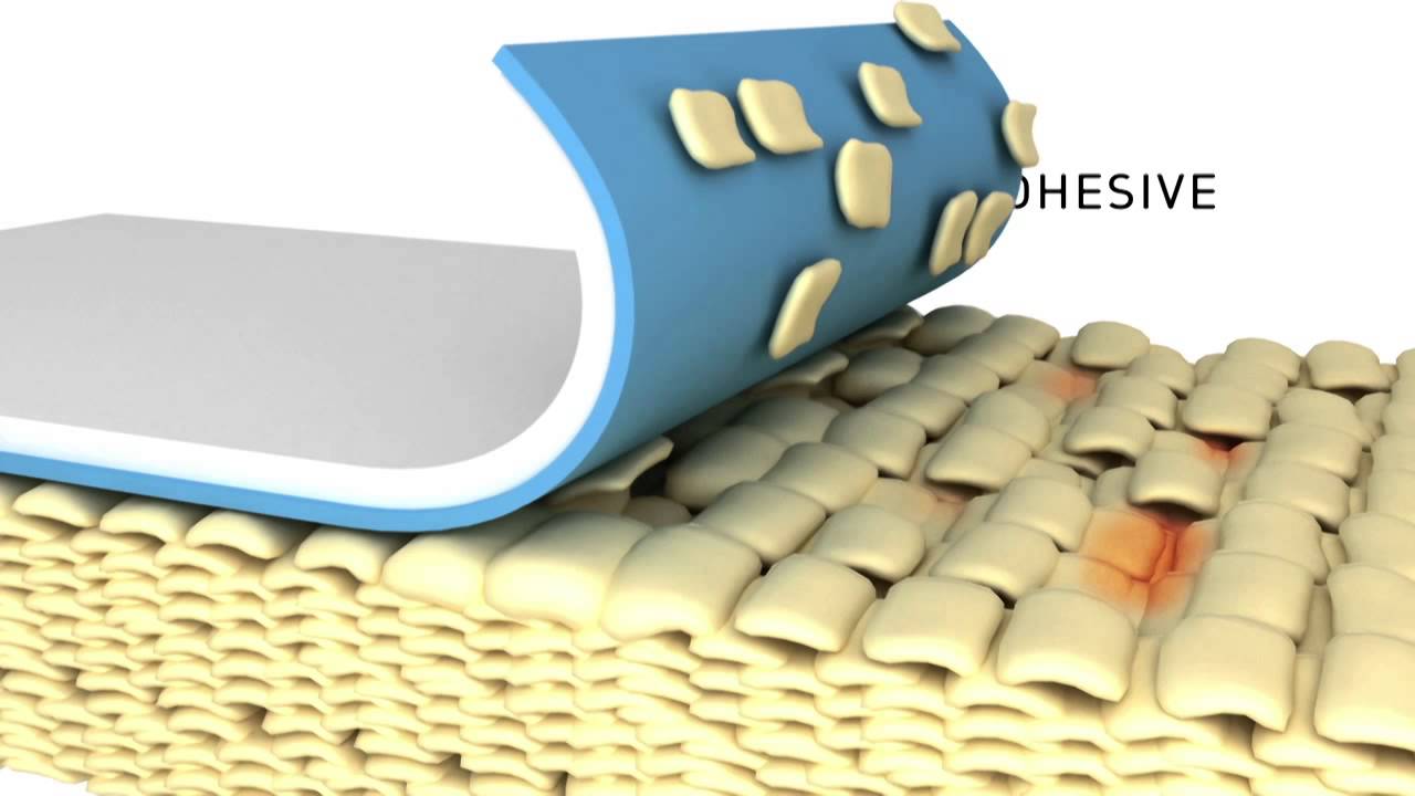 Safetac® Technologie - Mölnlycke Health Care - YouTube